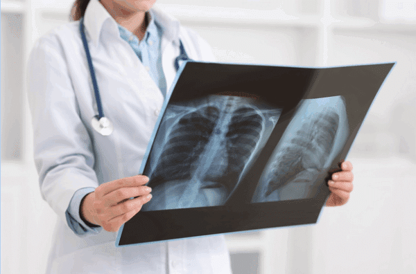 Does Urgent Care Do X-Rays? - Premier Family Medical